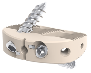 NovaSpine | Spinal solutions | Spinal implants | Spinal instruments
