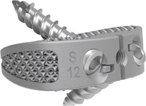 NovaSpine | Spinal solutions | Spinal implants | Spinal instruments